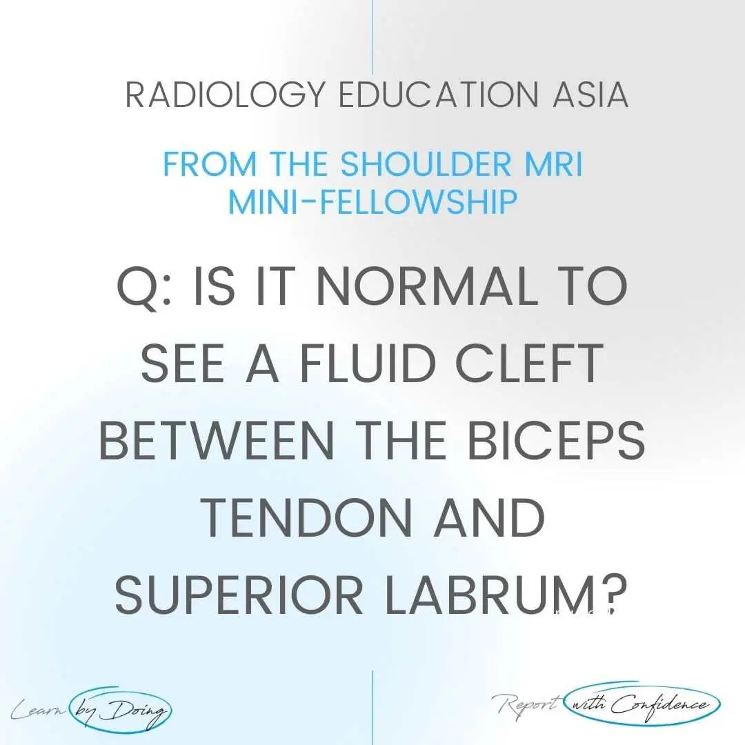 SHOULDER MRI BICEPS LABRUM JUNCTION: Q&A FROM THE COURSE - Radiology ...