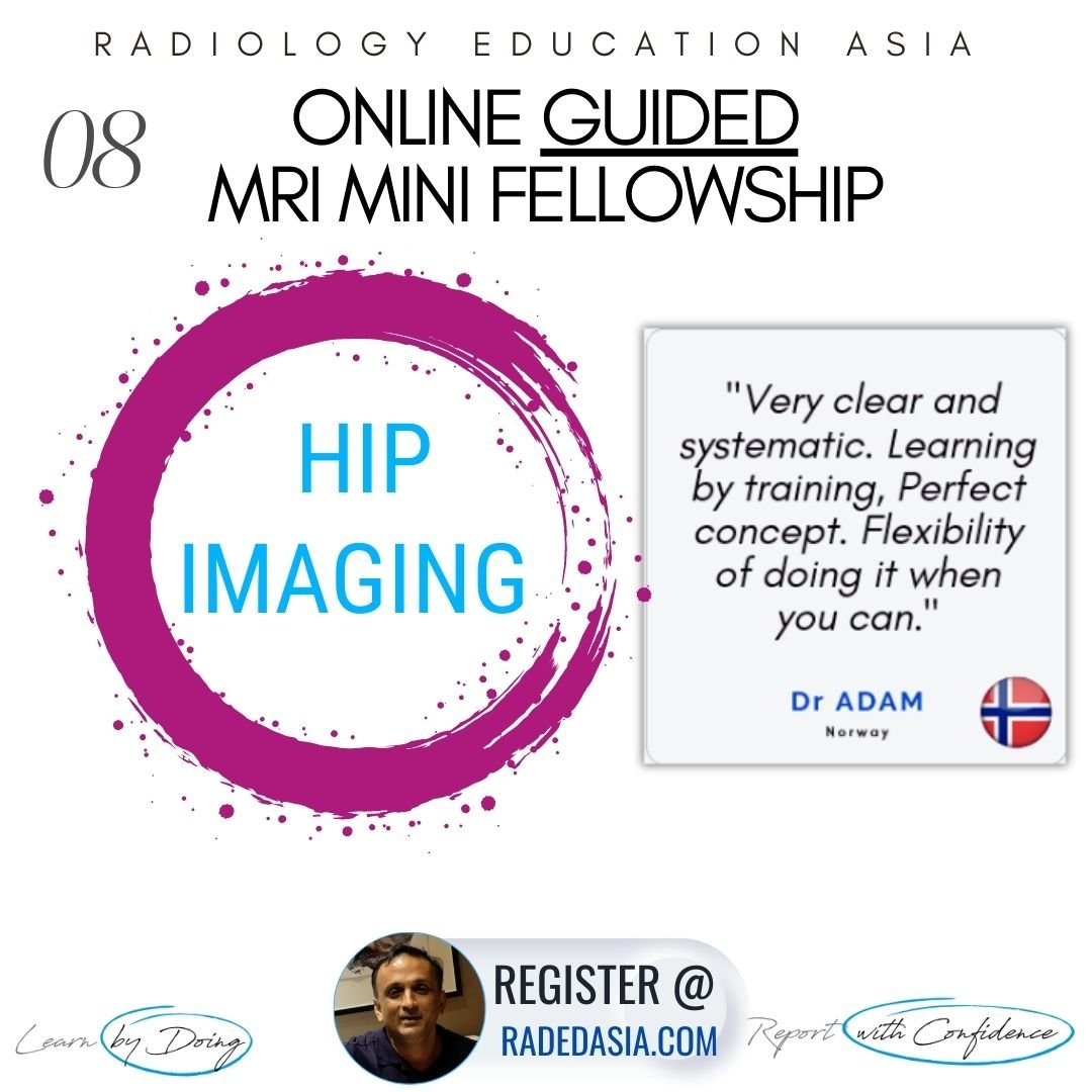 HIP LABRUM LABRAL TEAR MRI RADIOLOGY - Radiology Education Asia