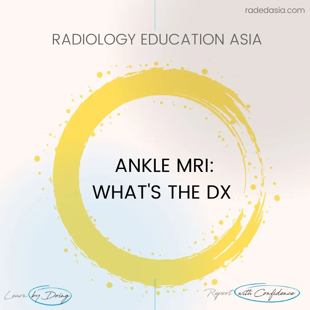 ANKLE MRI OS PERONEUM: WHAT IS THE DX - Radiology Education Asia