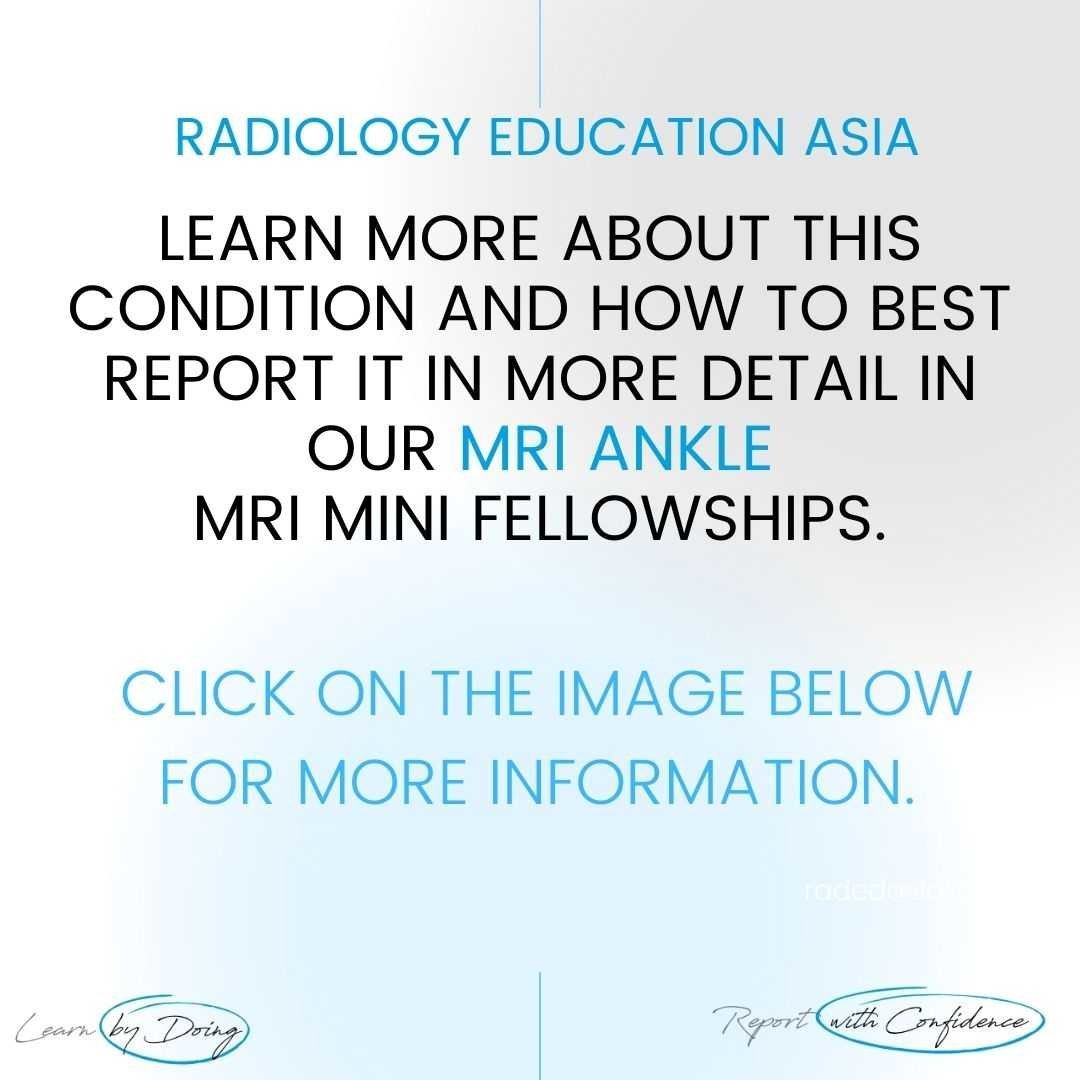 ANKLE SYNOVITIS MRI RADIOLOGY - Radiology Education Asia
