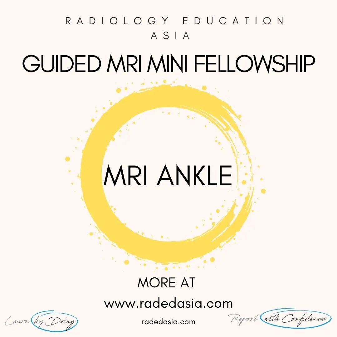 ANKLE SYNOVITIS MRI RADIOLOGY - Radiology Education Asia