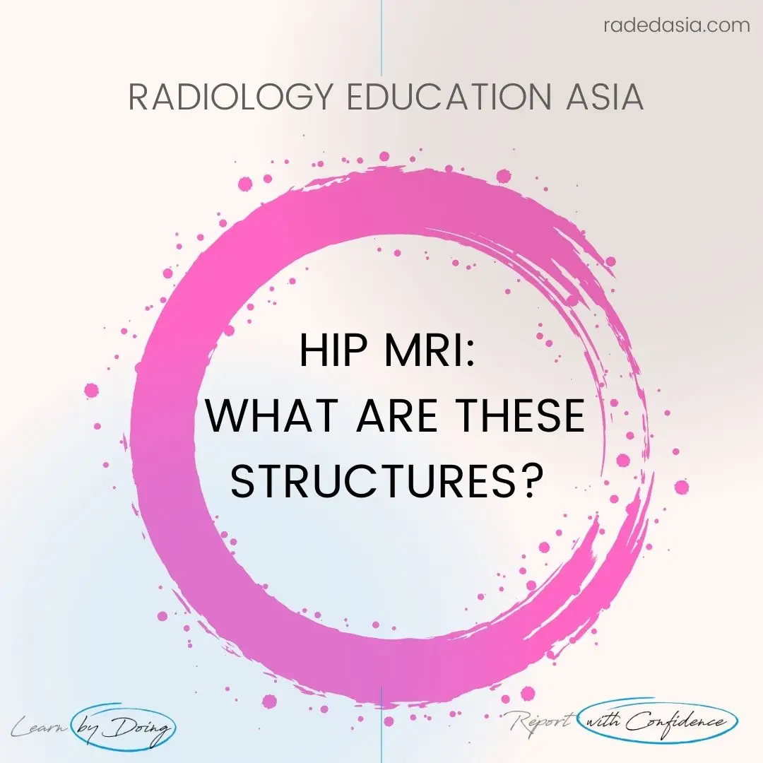 HIP MRI HAMSTRING CONJOINT TENDON ORIGIN ANATOMY - Radiology Education Asia