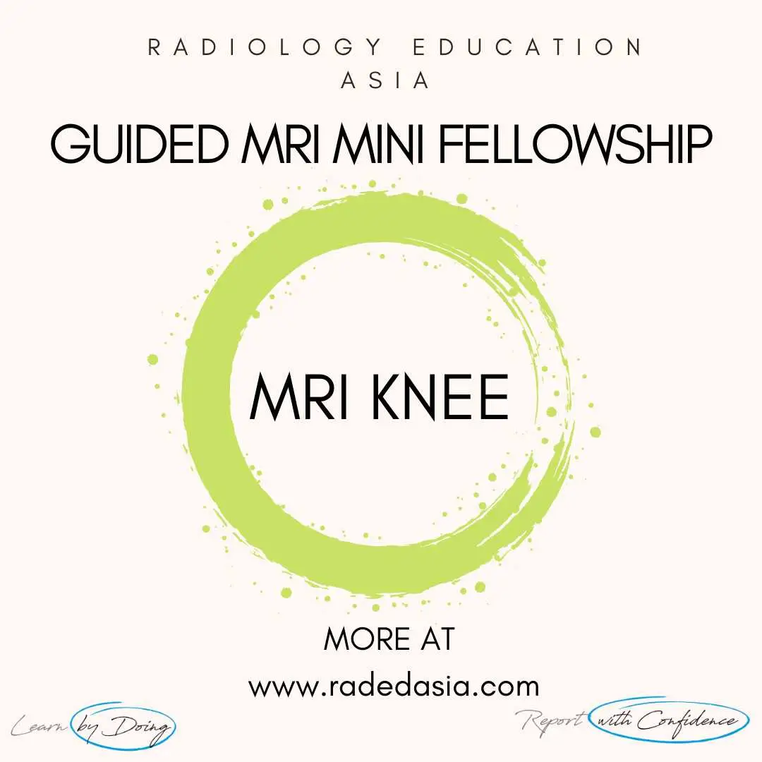 KNEE PLICA MRI MEDIAL PATELLAR PLICA RADIOLOGY - Radiology Education Asia