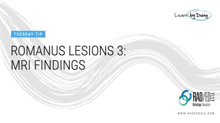ROMANUS LESION MRI FINDINGS CORNER INFLAMMATORY LESIONS - Radiology ...