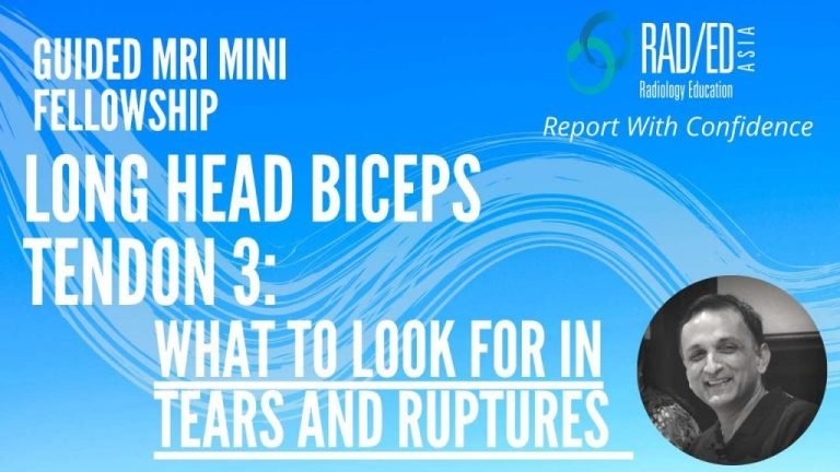 MRI BICEPS TENDON TEAR & RUPTURE (VIDEO) - Radiology Education Asia