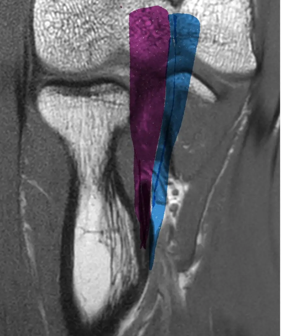 MRI ELBOW ONLINE GUIDED MINI FELLOWSHIP - Radiology Education Asia