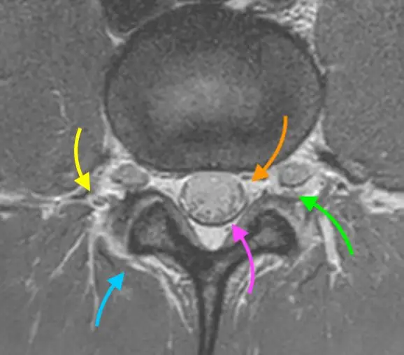 SPINE & SIJ IMAGING FOR PAIN MANAGEMENT - Radiology Education Asia